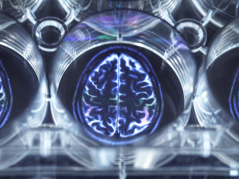 What Does Ozempic Do to Your Brain?
